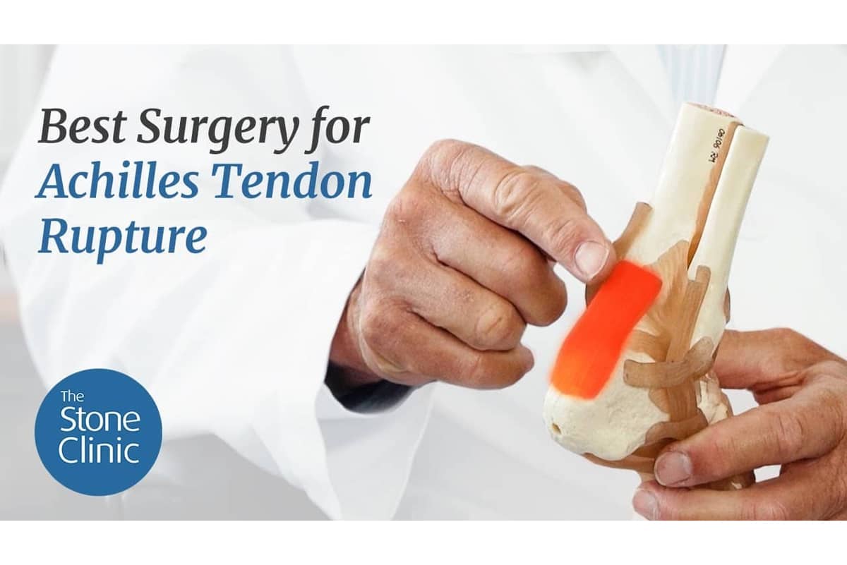Best Surgery for Achilles Tendon Rupture (Video Blog)
