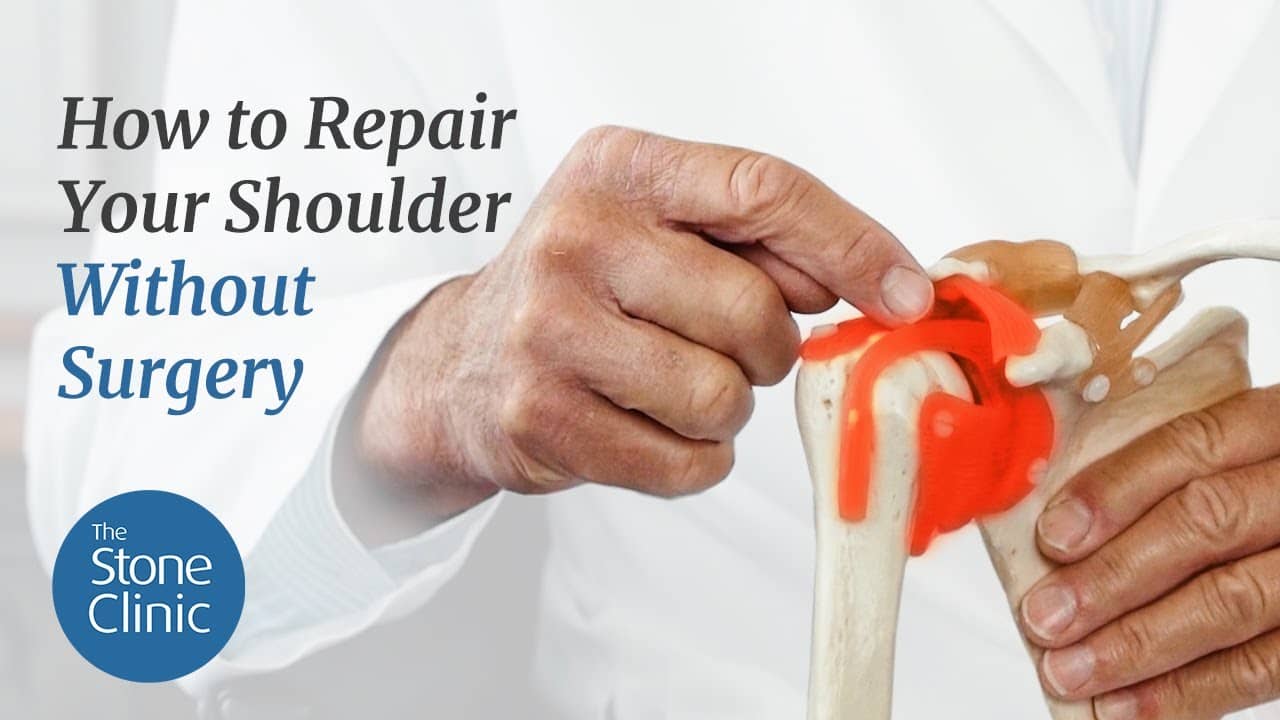 How to Repair Your Shoulder Without Surgery