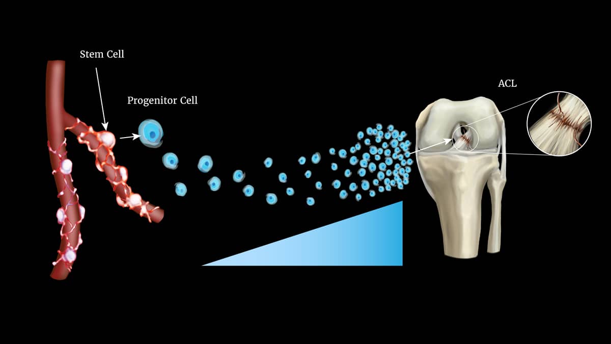 Myths and Facts About Stem Cell Therapies