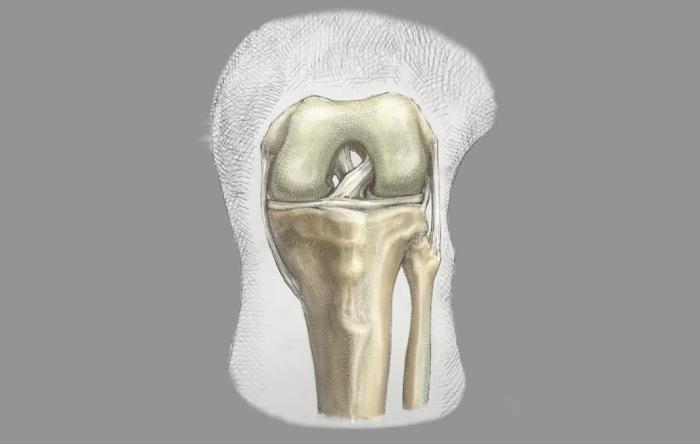 ACL Reconstruction Rehab Protocol & Recovery Time Frame